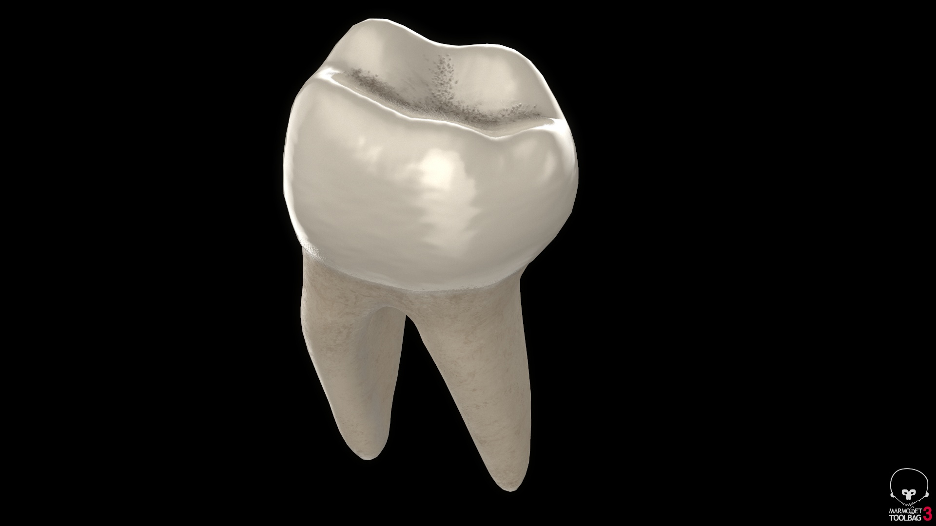 Molar Tooth 3D Model - TurboSquid 1489906