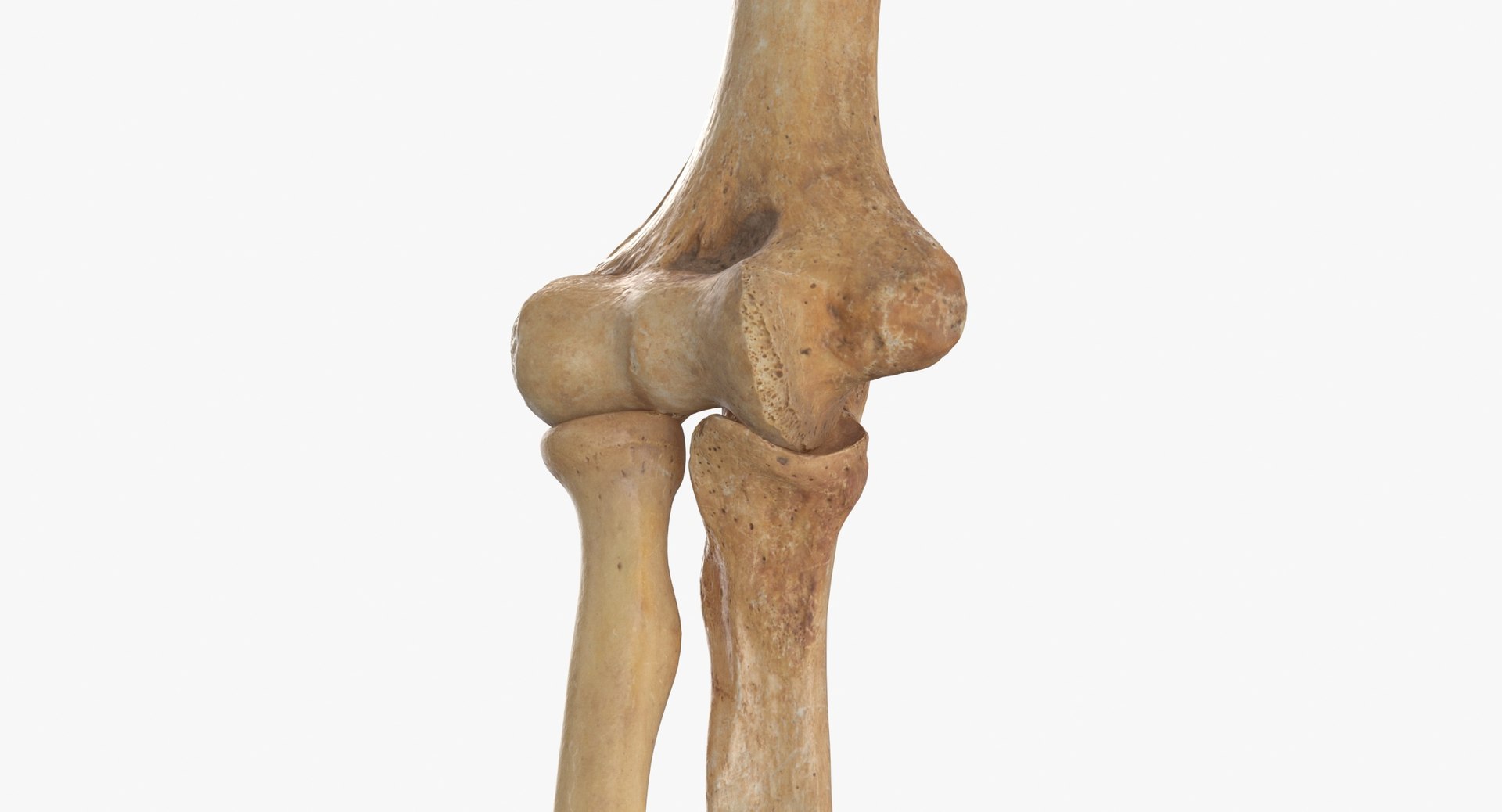 Real human arm scapula model - TurboSquid 1627302