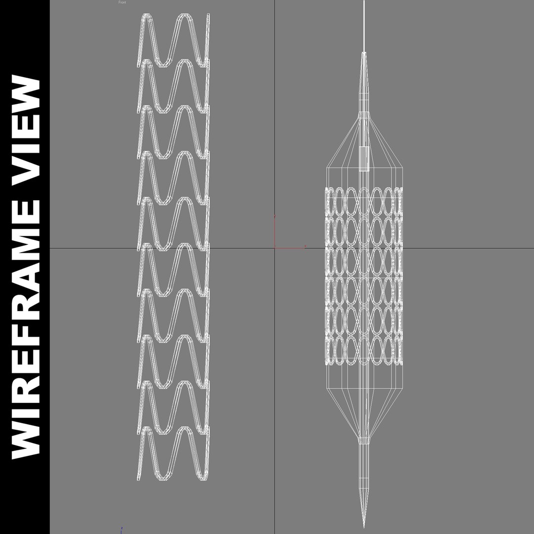 Stent Balloon 3d 3ds
