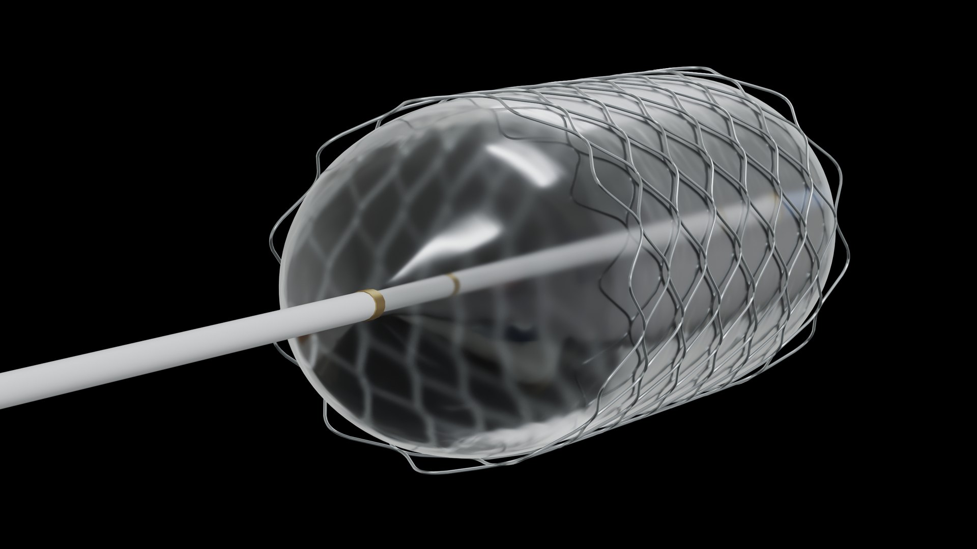3D medical balloon-expandable stent - TurboSquid 1701176