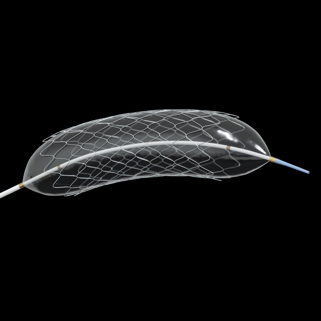 3D medical balloon-expandable stent - TurboSquid 1701176