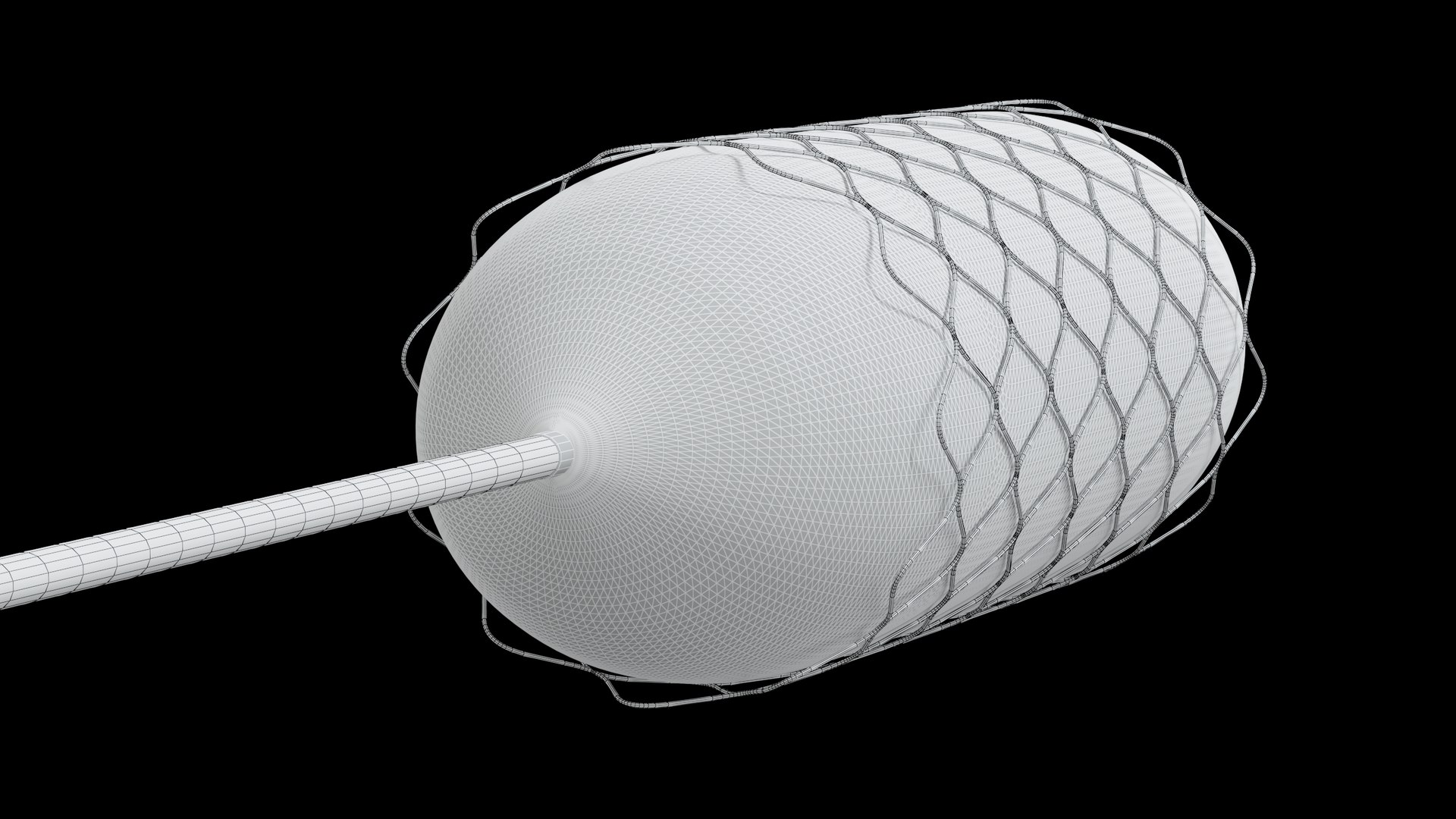 3D medical balloon-expandable stent - TurboSquid 1701176