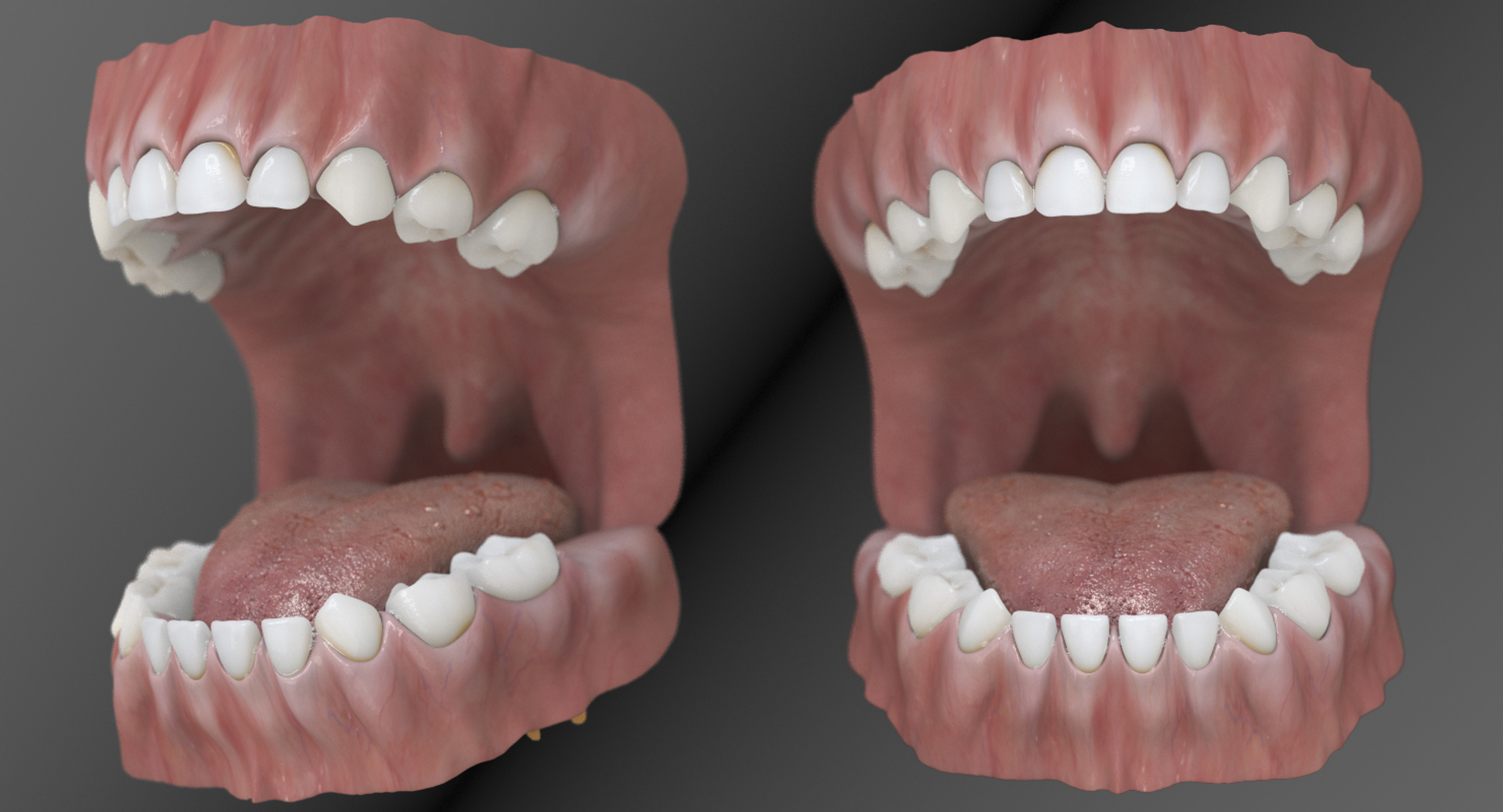 Primary Dentition Mannequin 3D Model - TurboSquid 1515971