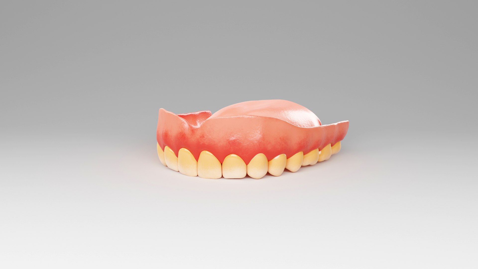 3D Dental Prosthesis Model - TurboSquid 1656080