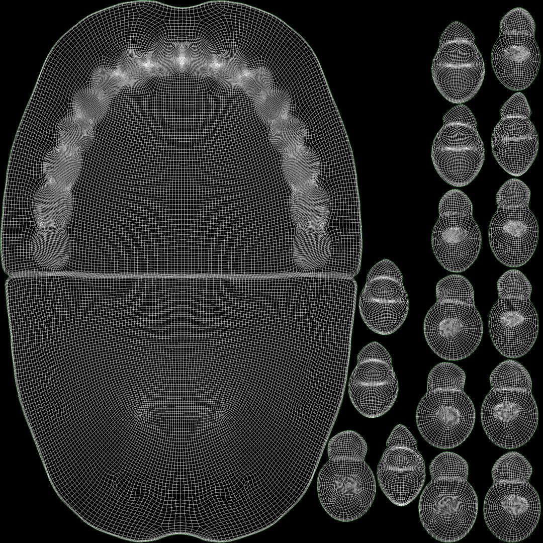 3D Dental Prosthesis Model - TurboSquid 1656080