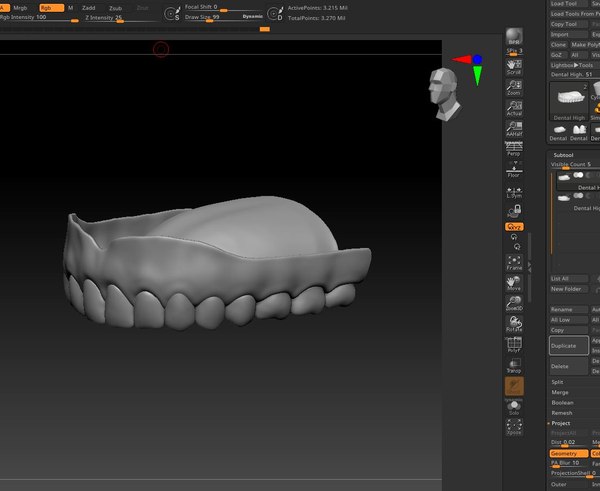 3D dental prosthesis model - TurboSquid 1656080