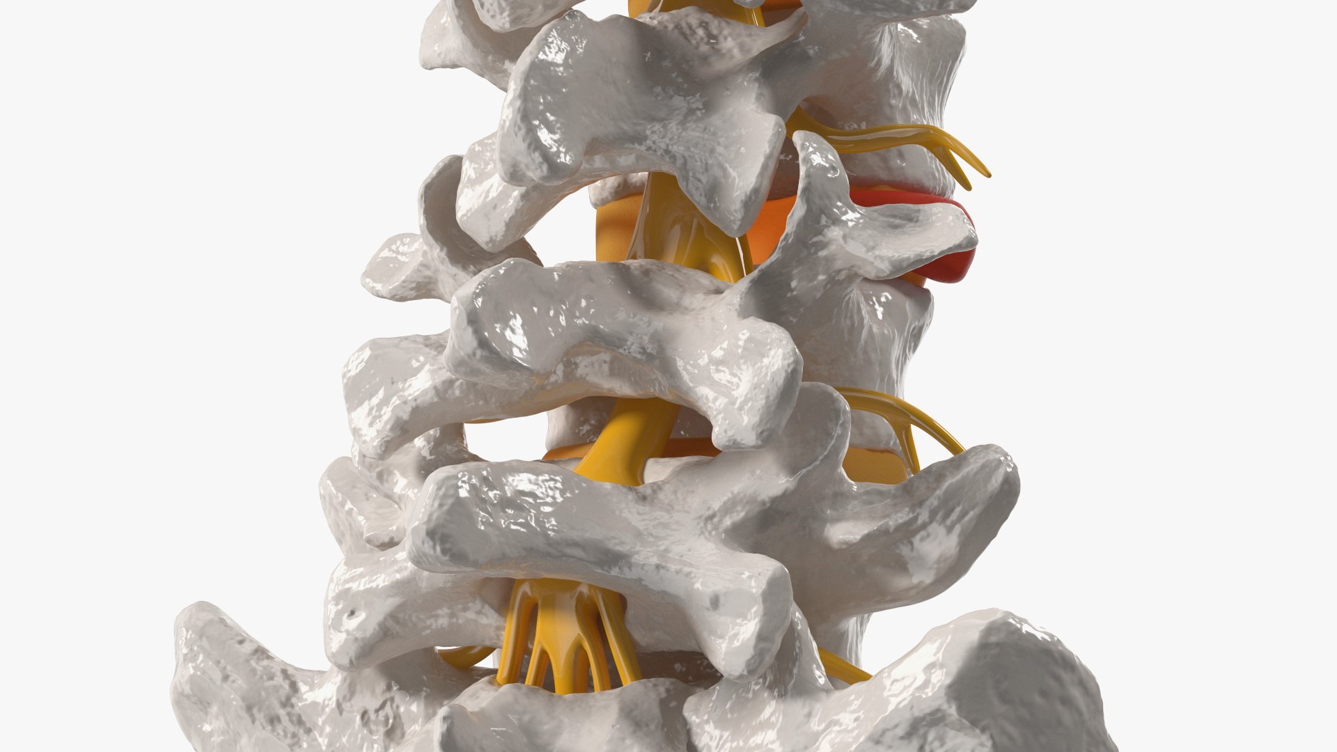 Spinal Column with Hernia on Stand 3D - TurboSquid 2051092