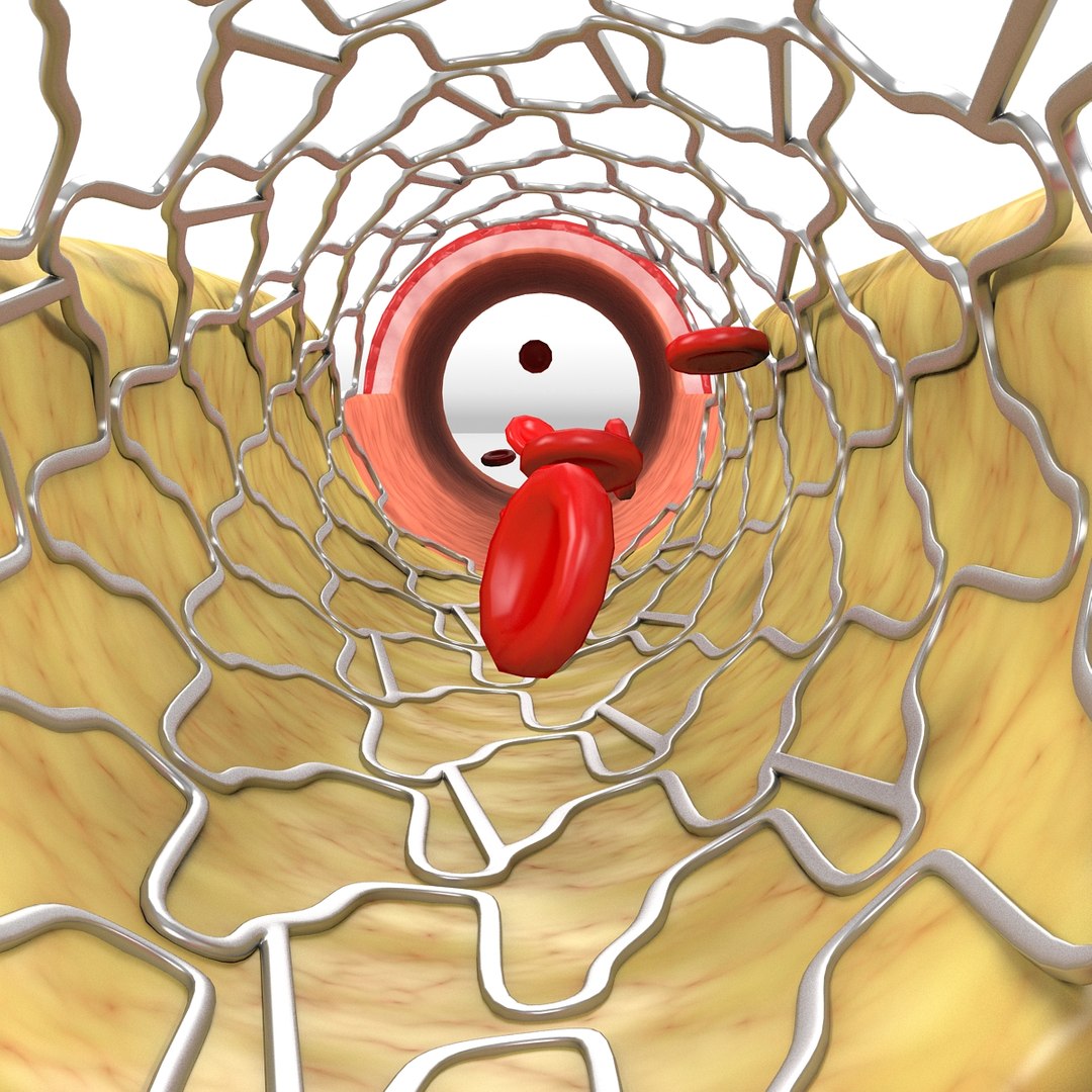 Medical Cardiovascular Stent 3d Model