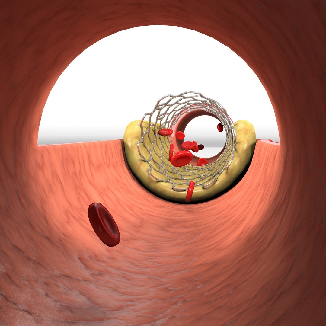 Medical Cardiovascular Stent 3d Model