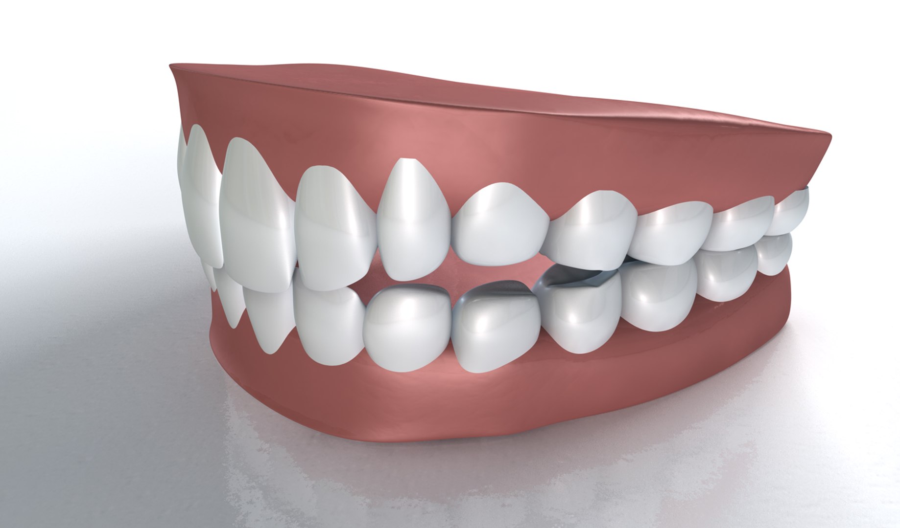 3d Sets Human Teeth
