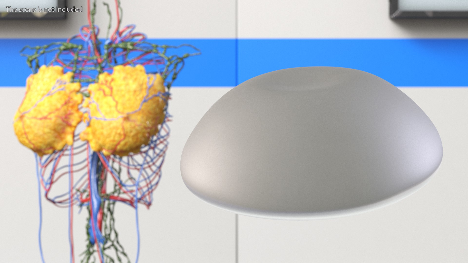 3D Textured Full Breast Implant model - TurboSquid 2164181