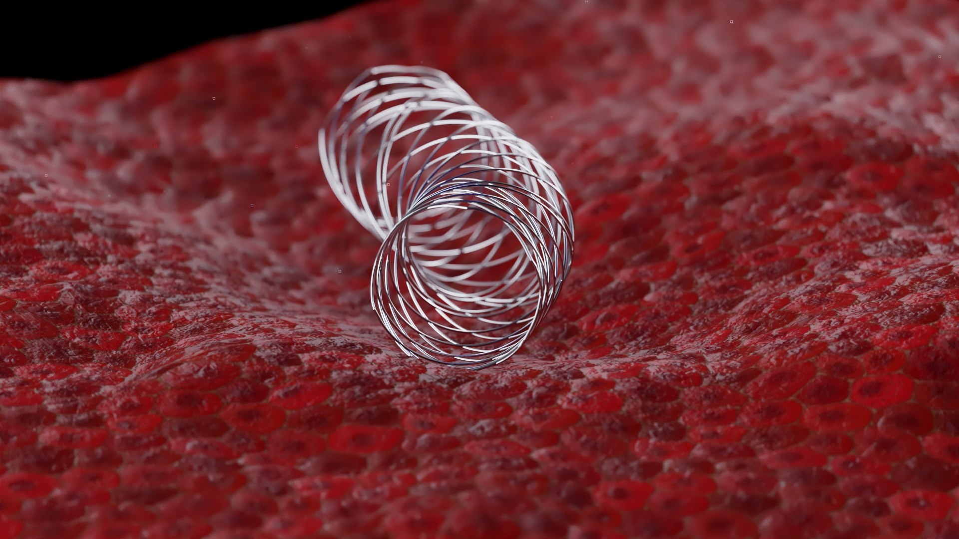 3D Model Stent Medicine Science - TurboSquid 1681496