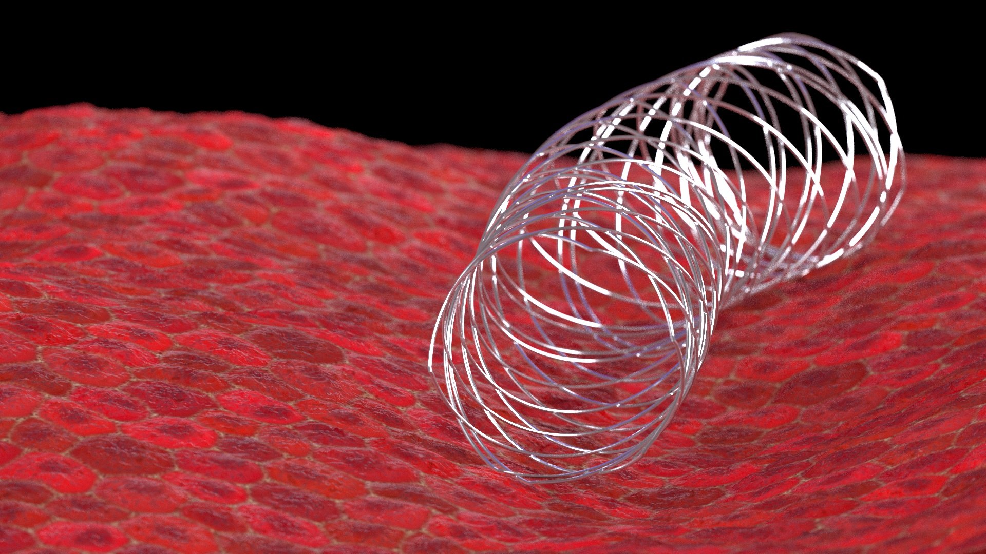 3D Model Stent Medicine Science - TurboSquid 1681496