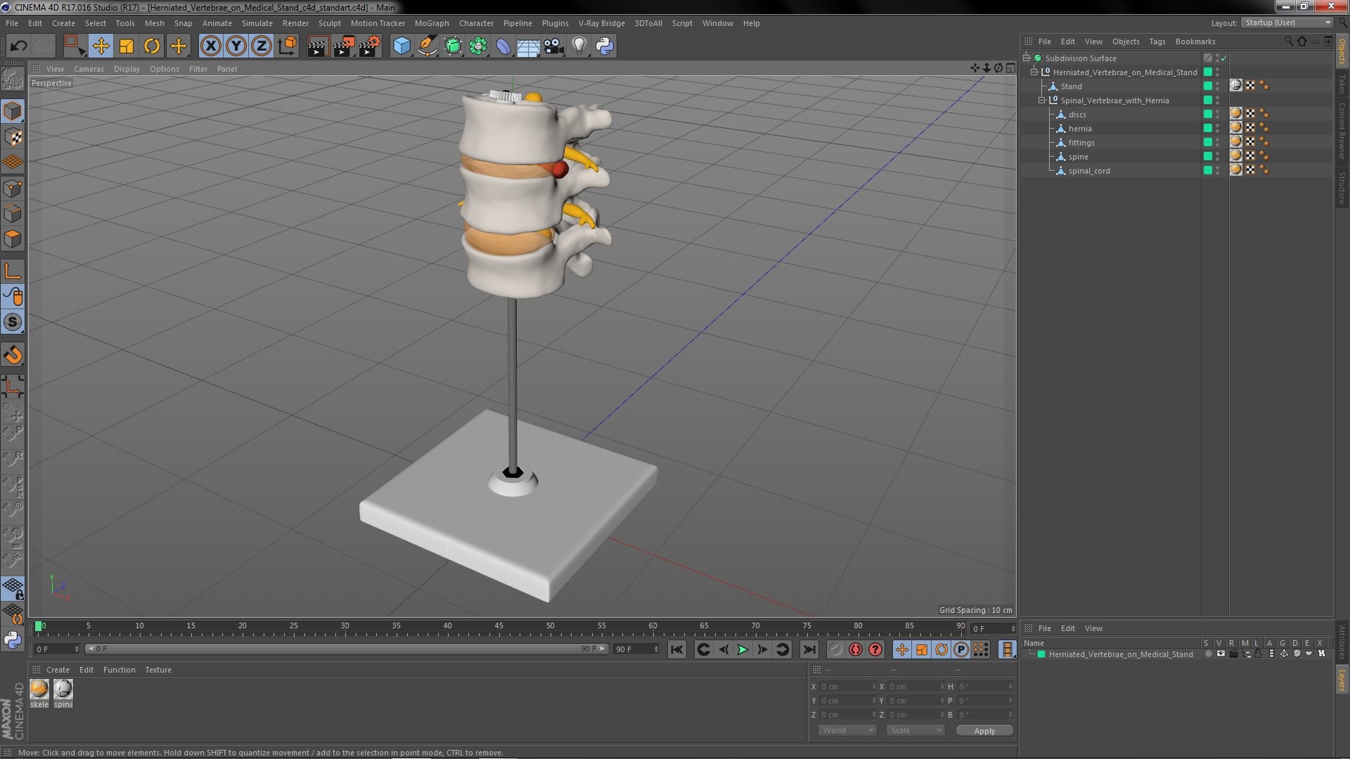 3D Herniated Vertebrae on Medical Stand model - TurboSquid 2044661