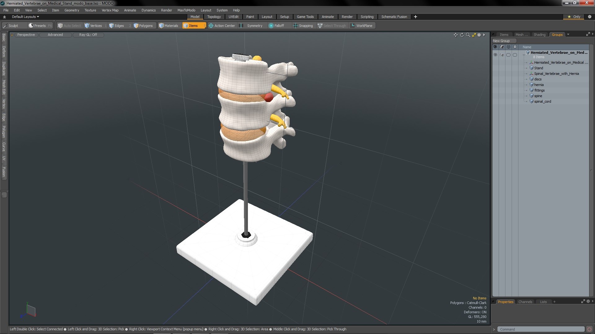 3D Herniated Vertebrae on Medical Stand model - TurboSquid 2044661
