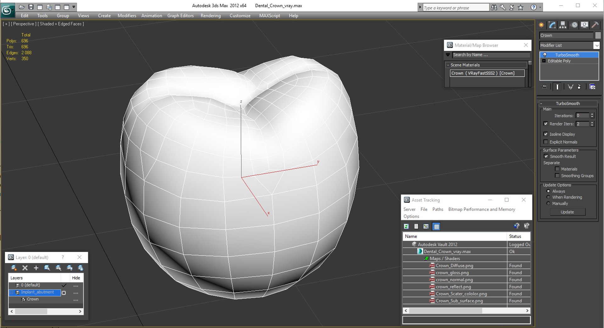 3D Dental Crown Model - TurboSquid 1428836