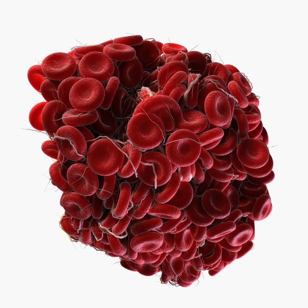 3d Blood Clot