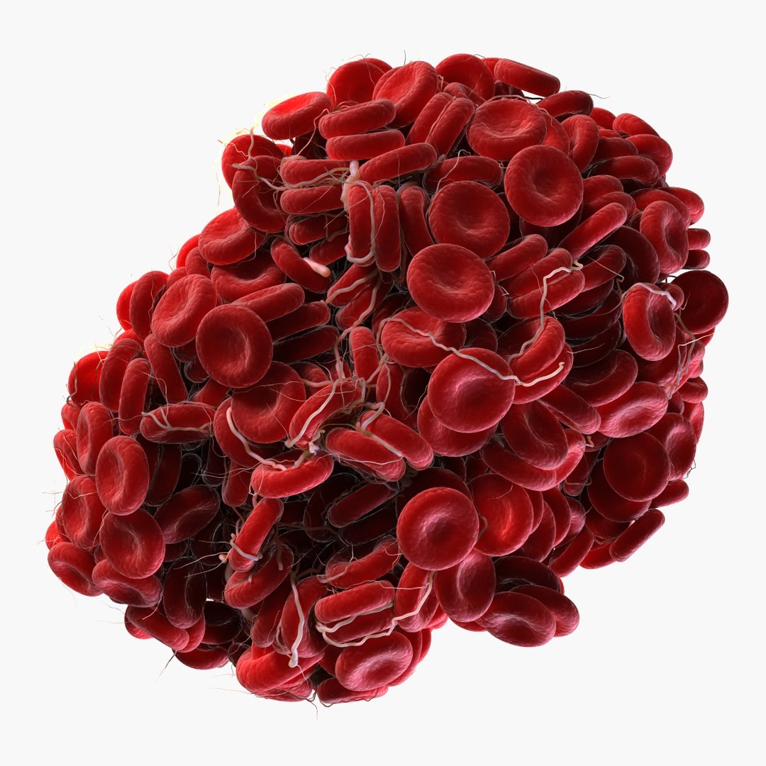 3d Blood Clot