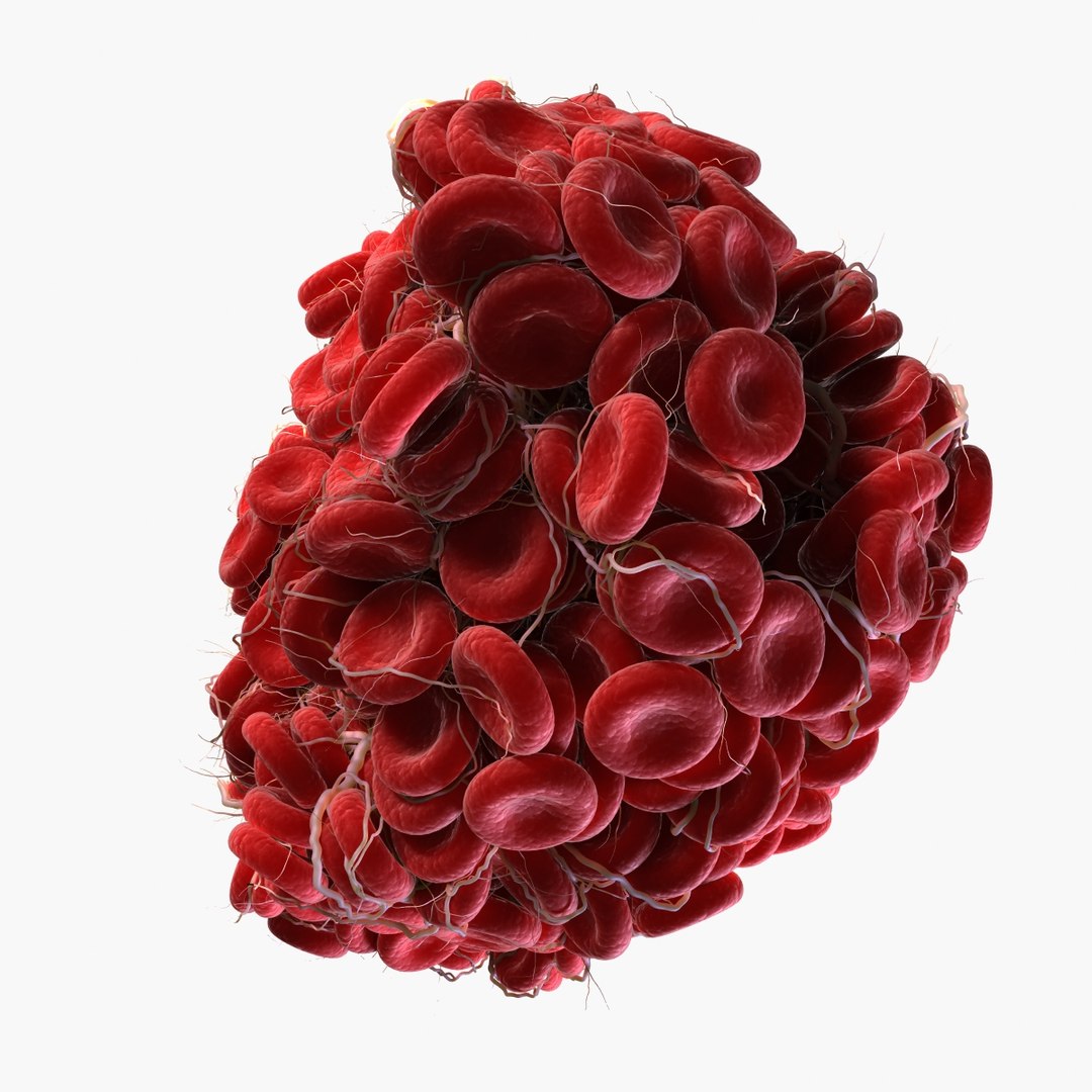 3d Blood Clot