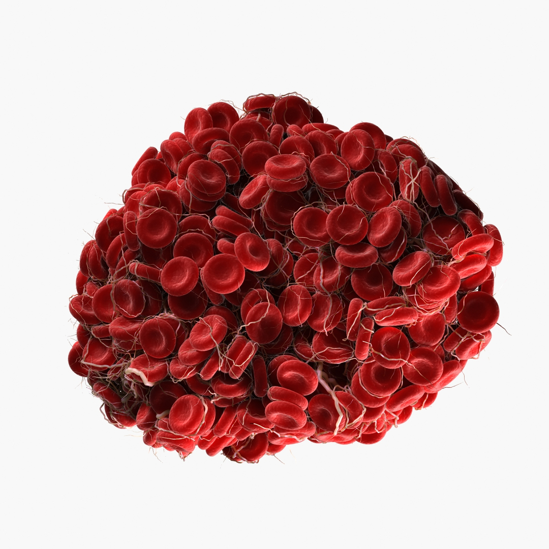 3d Blood Clot