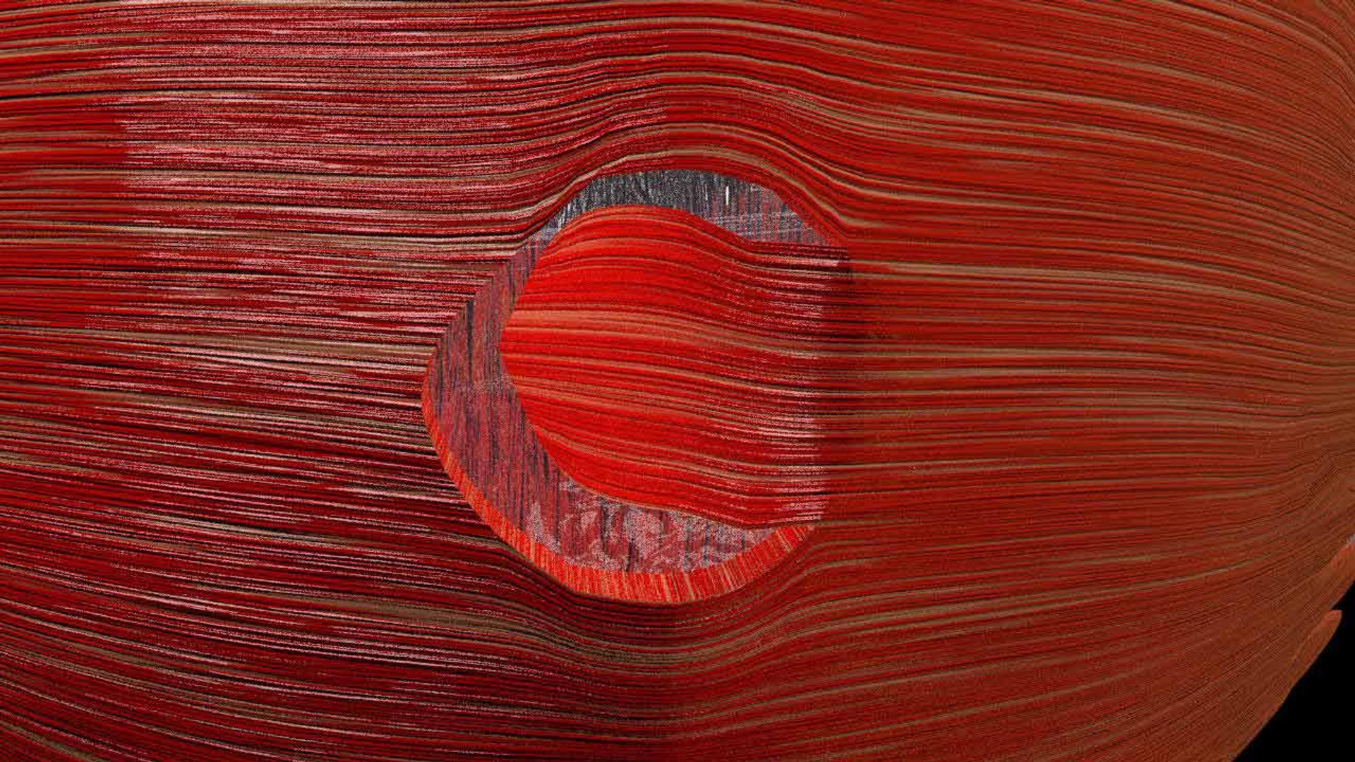 Retinal Detachment Types Eye 3D Model - TurboSquid 1774876