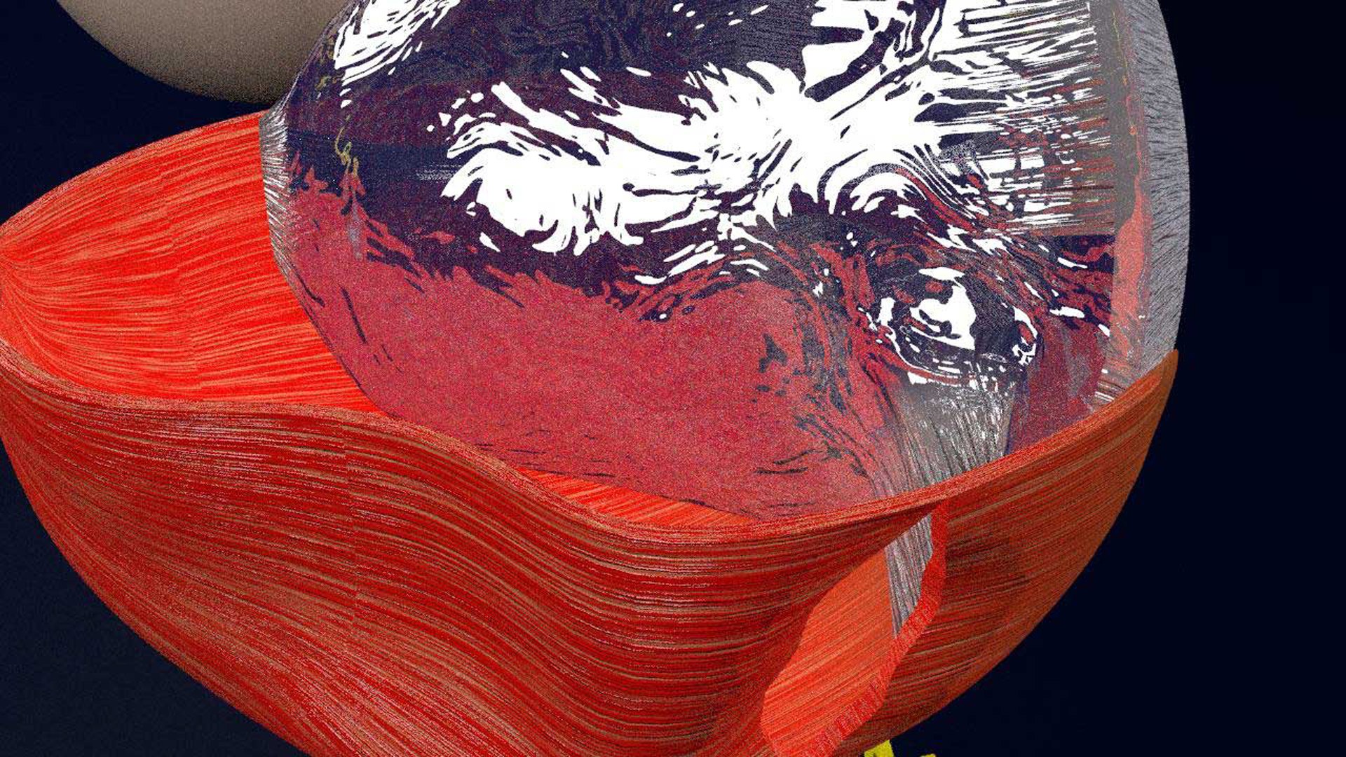 Retinal Detachment Types Eye 3D Model - TurboSquid 1774876