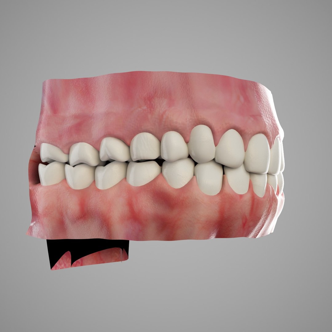 3d Human Teeth Head
