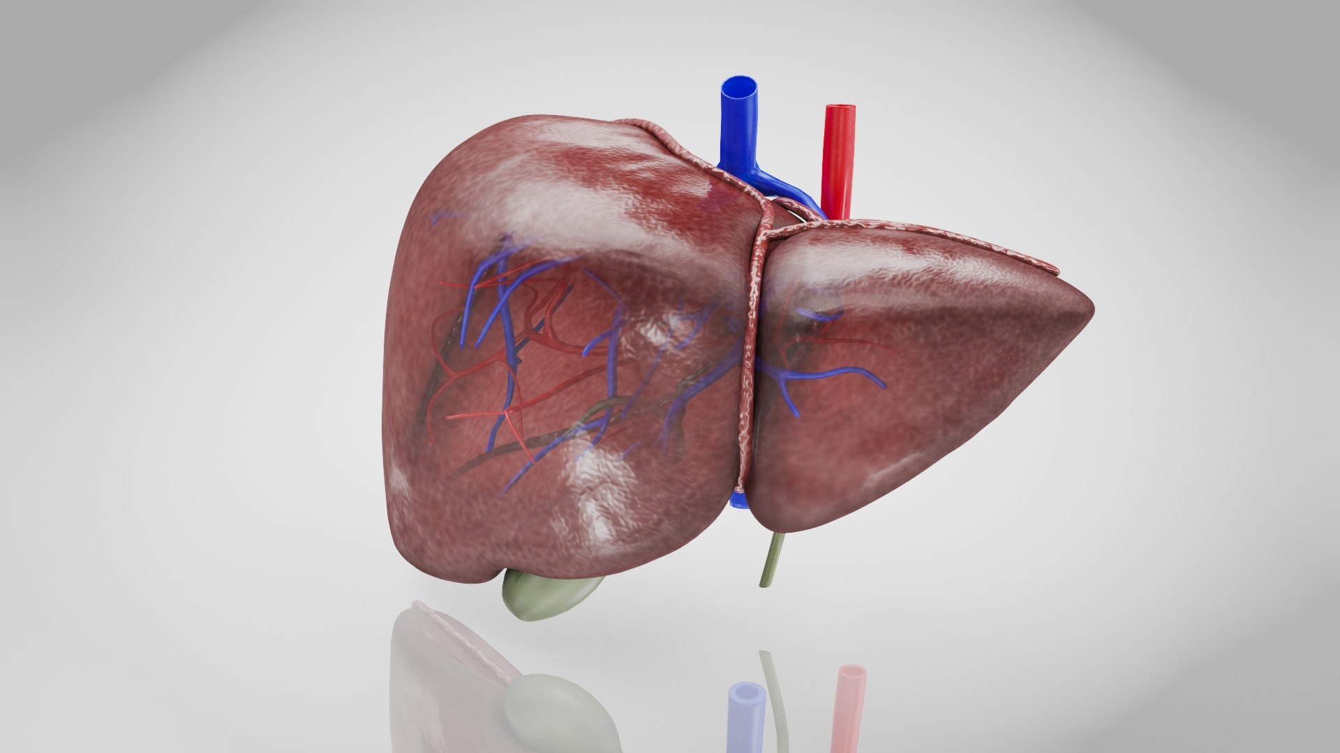 3D Liver Diseases - TurboSquid 2132860