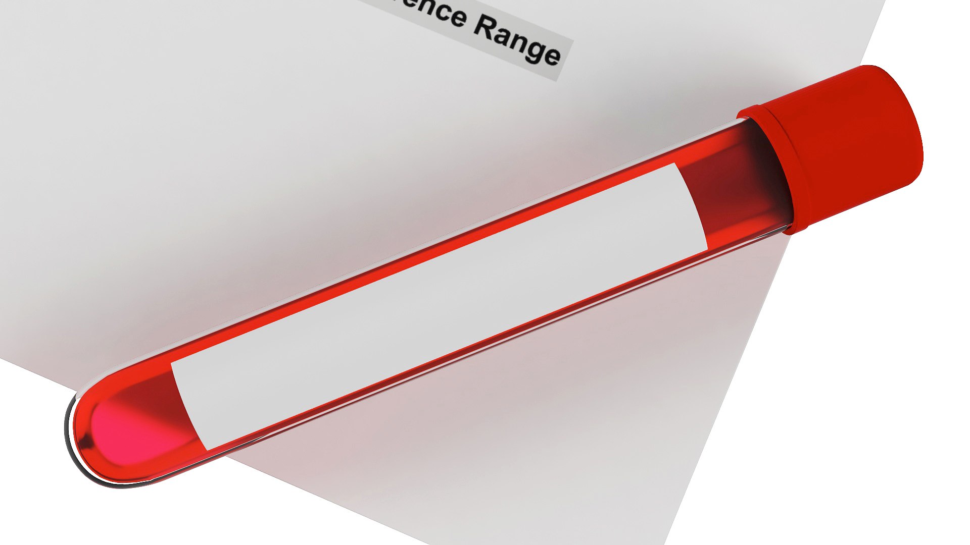 3D Laboratory HIV Report With Blood Tube Positive Model - TurboSquid ...