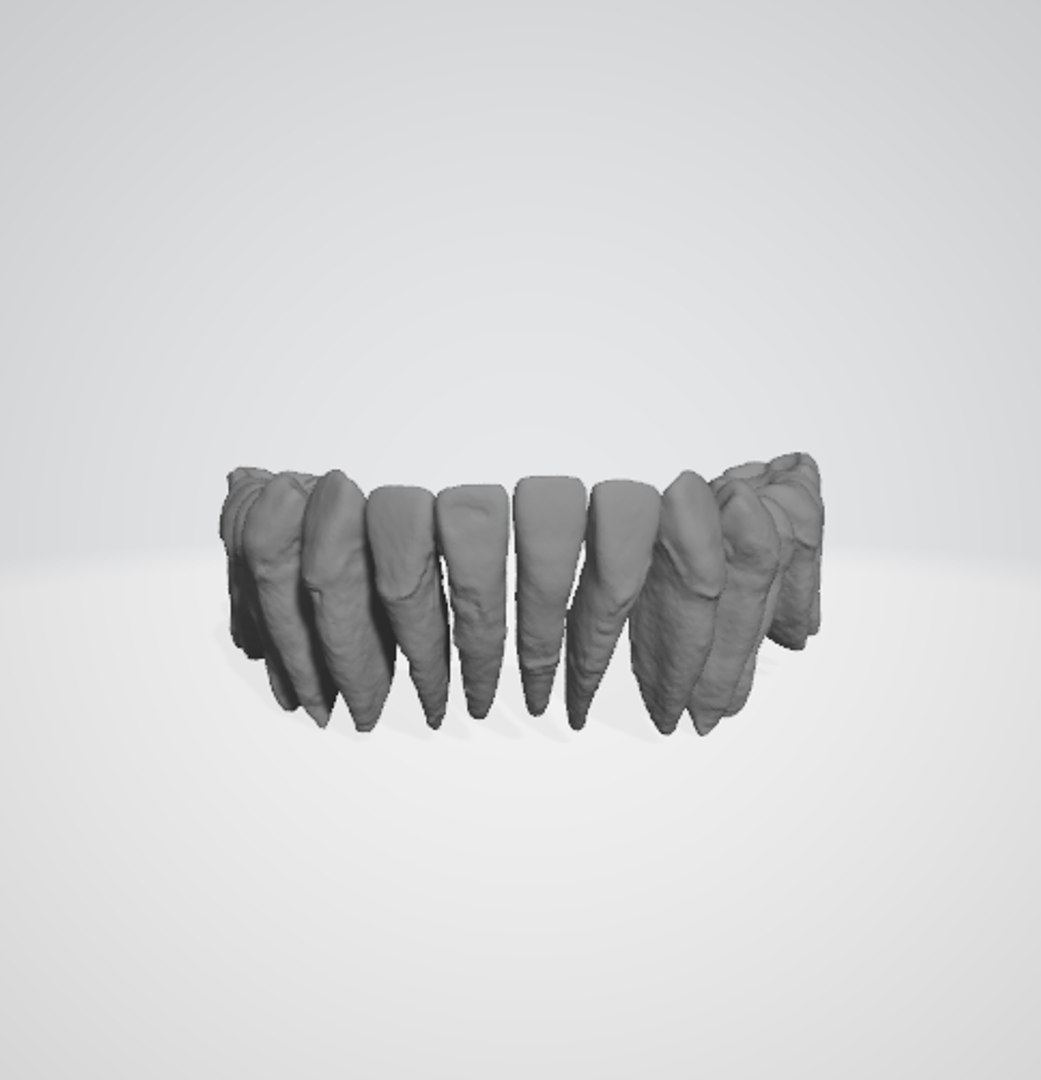 Dental Arch 3D Model - TurboSquid 1363773
