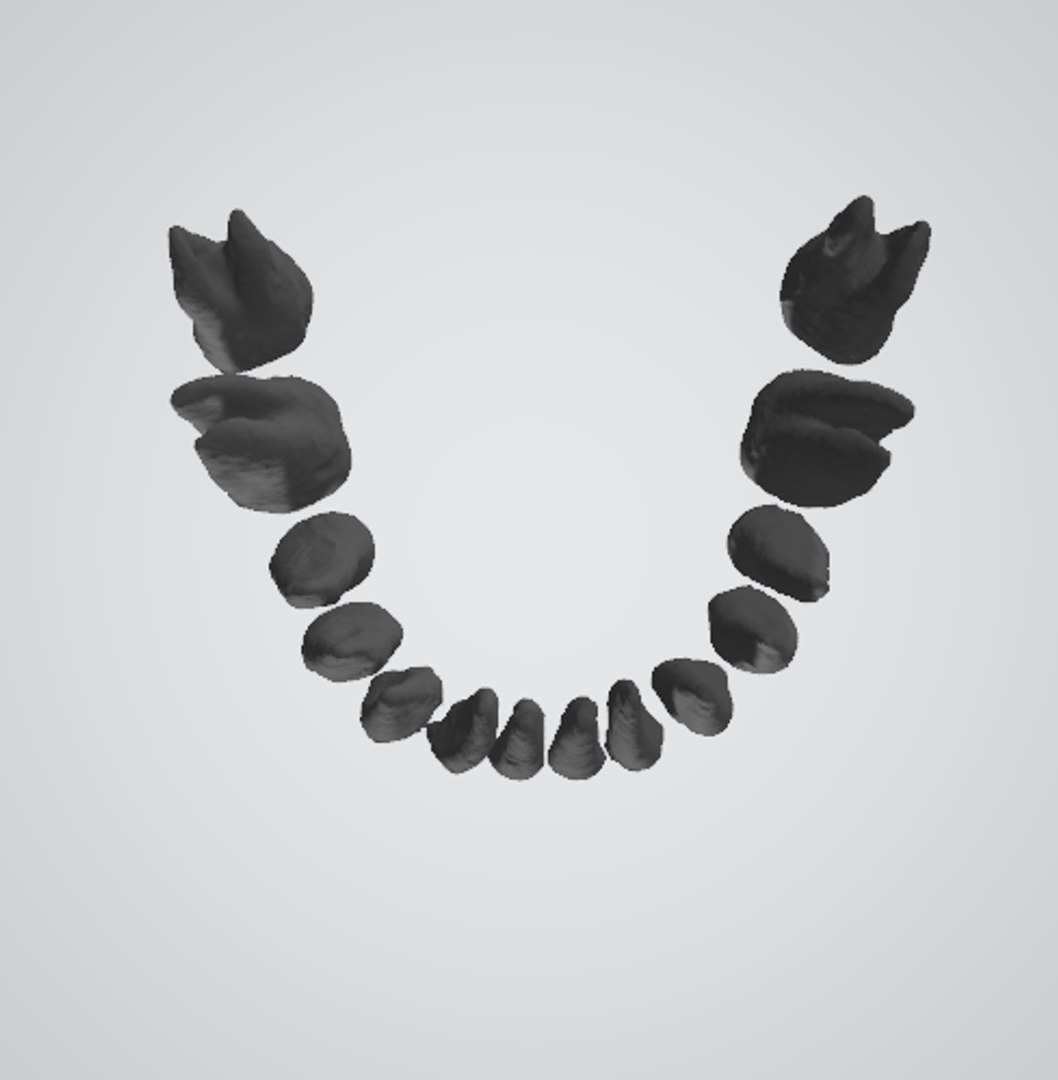 Dental Arch 3D Model - TurboSquid 1363773