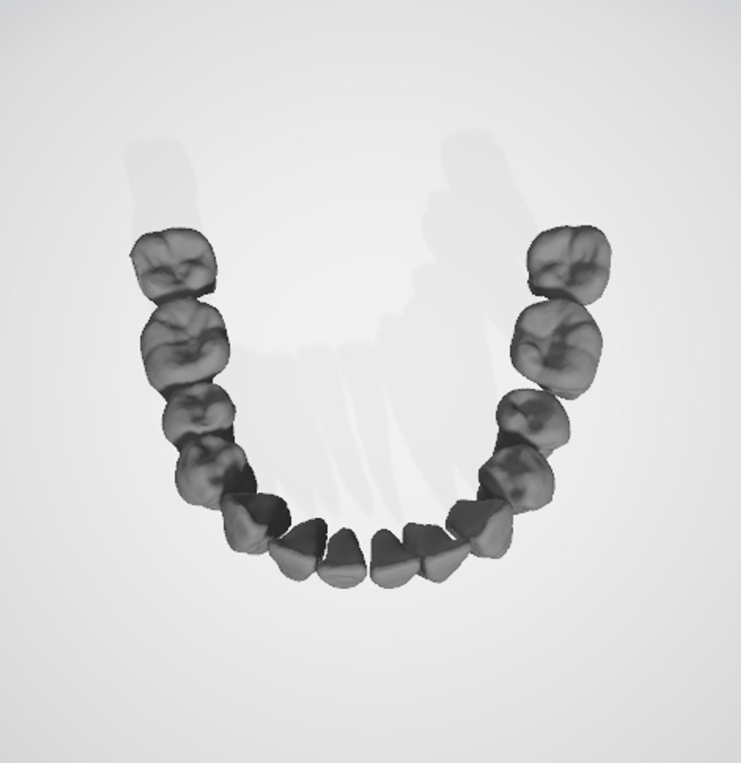 Dental Arch 3D Model - TurboSquid 1363773