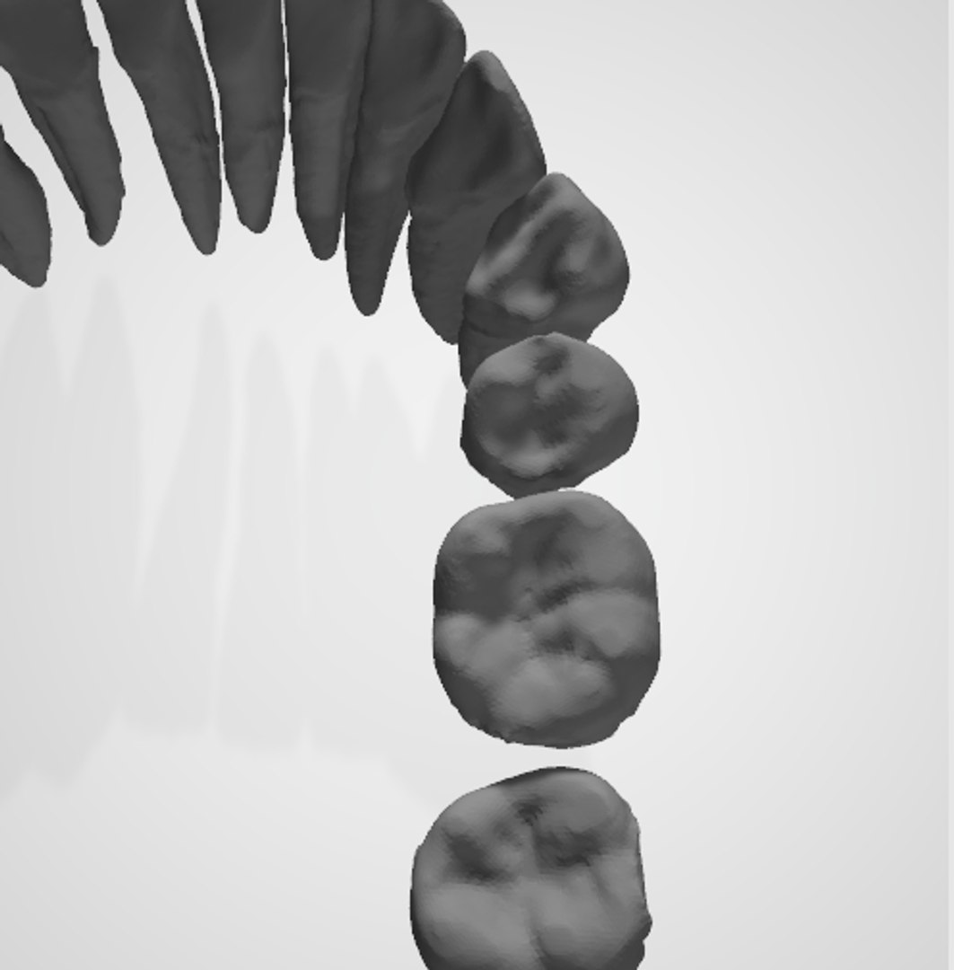 Dental Arch 3D Model - TurboSquid 1363773