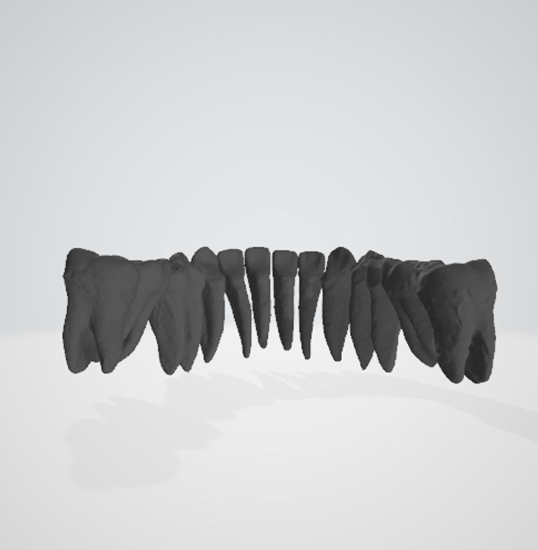 Dental Arch 3D Model - TurboSquid 1363773