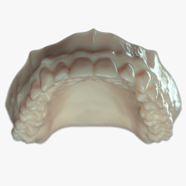 3D Denture Models | TurboSquid
