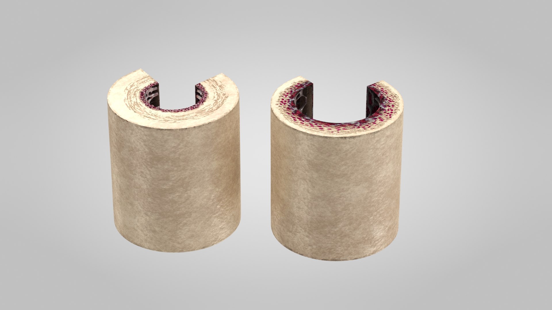 3D Healthy And Osteoporotic Bone Section - TurboSquid 1803066