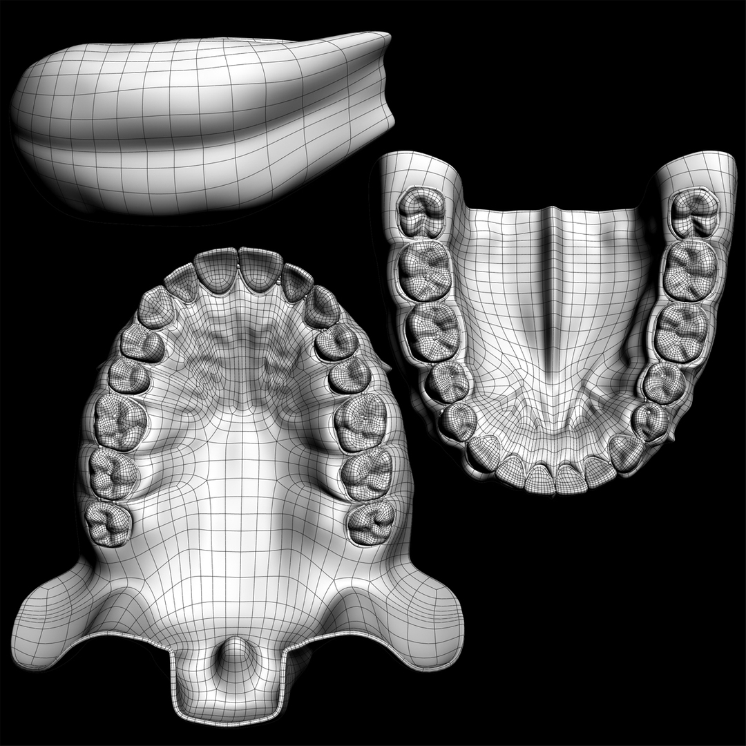 3d model orthodontics mouth teeth