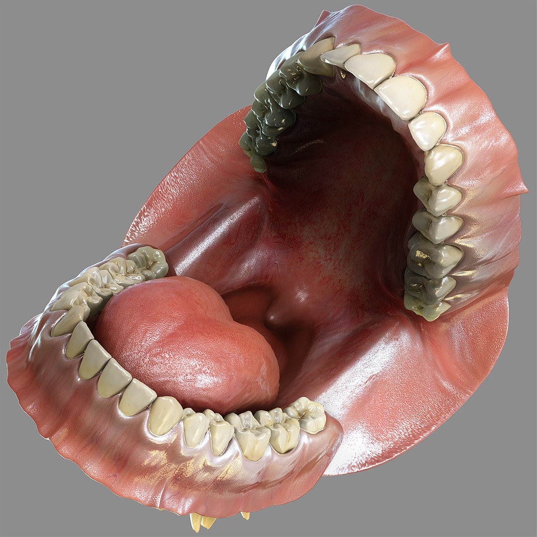 3d Model Orthodontics Mouth Teeth