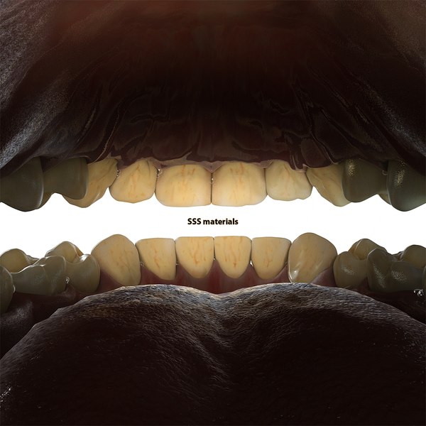 3d model orthodontics mouth teeth