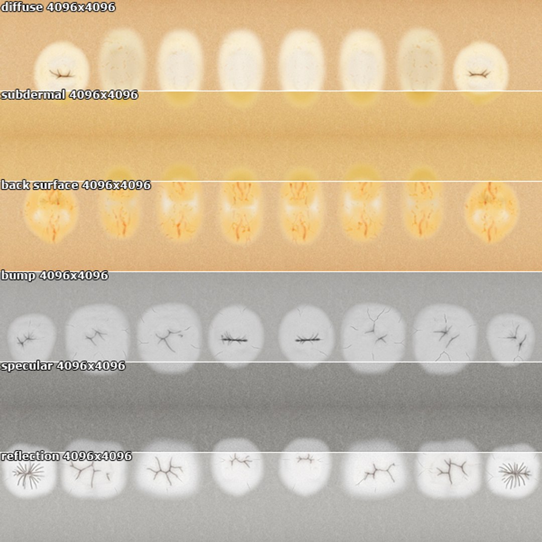 3d Model Orthodontics Mouth Teeth