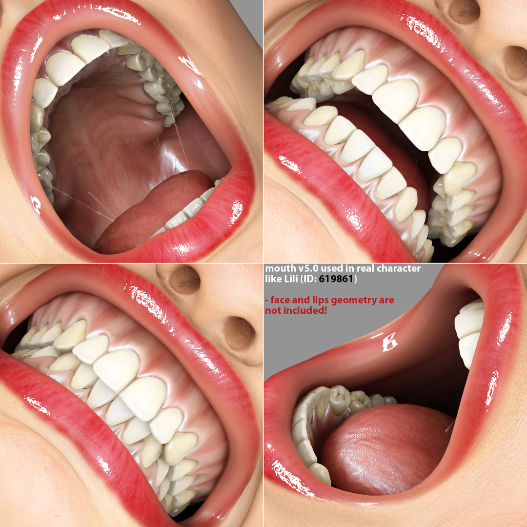 3d model orthodontics mouth teeth