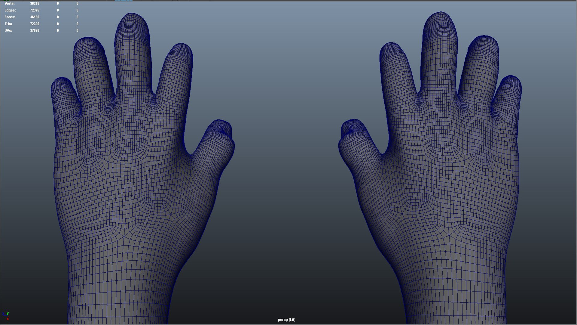 3D Leprosy Hansen Chronic Infectious Disease - TurboSquid 2184634