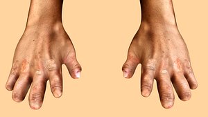 3D Infectious Models | TurboSquid