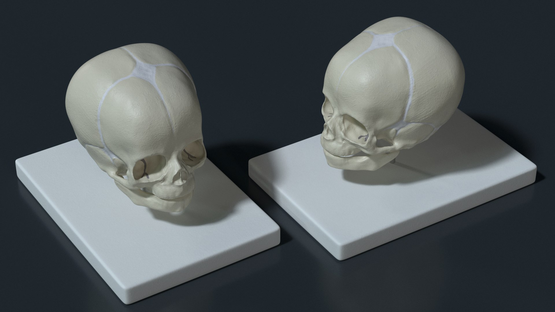 Full-Term Fetal Skull Plastic Medical Display 3D Model - TurboSquid 2409840