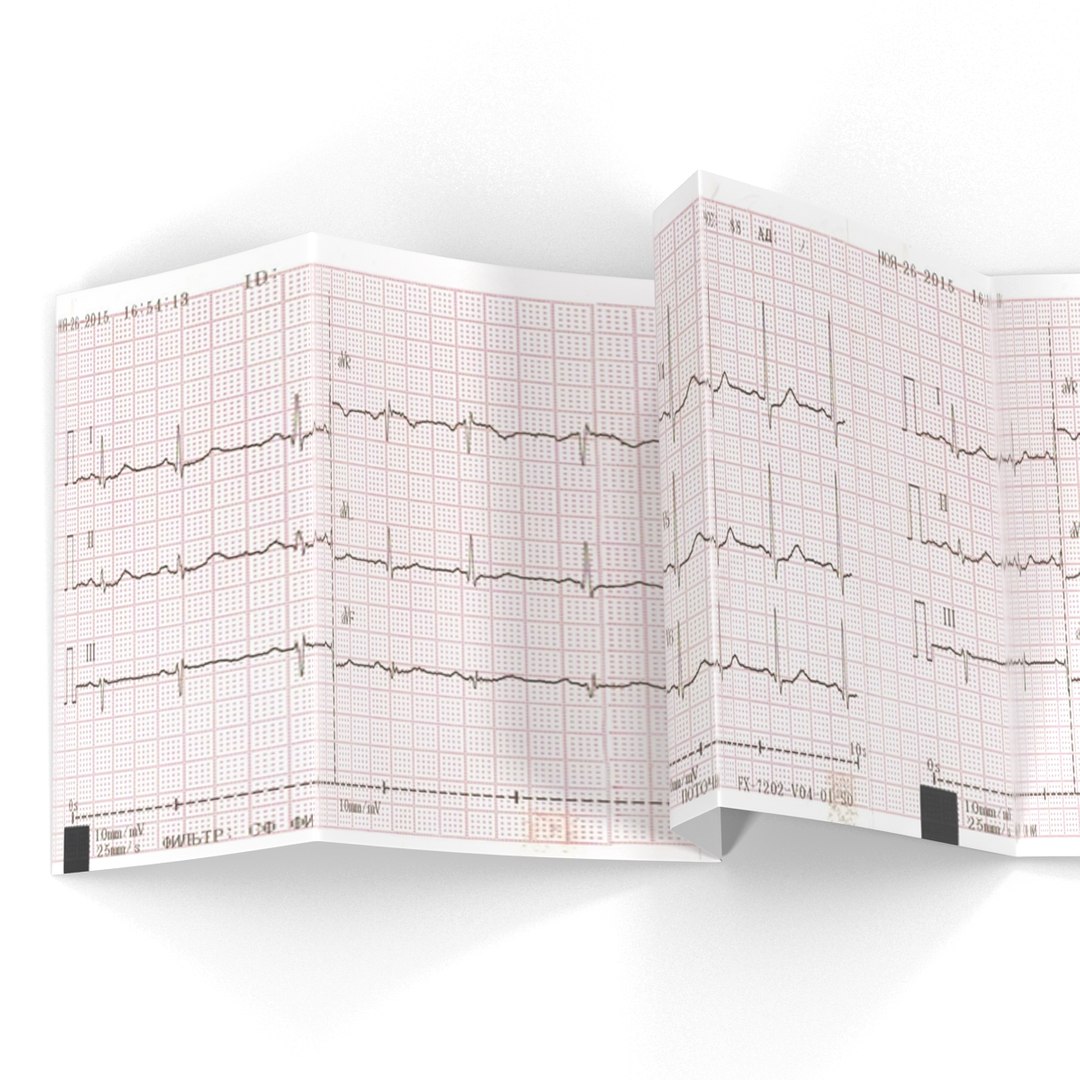 Electrocardiograph Report Paper Form Max
