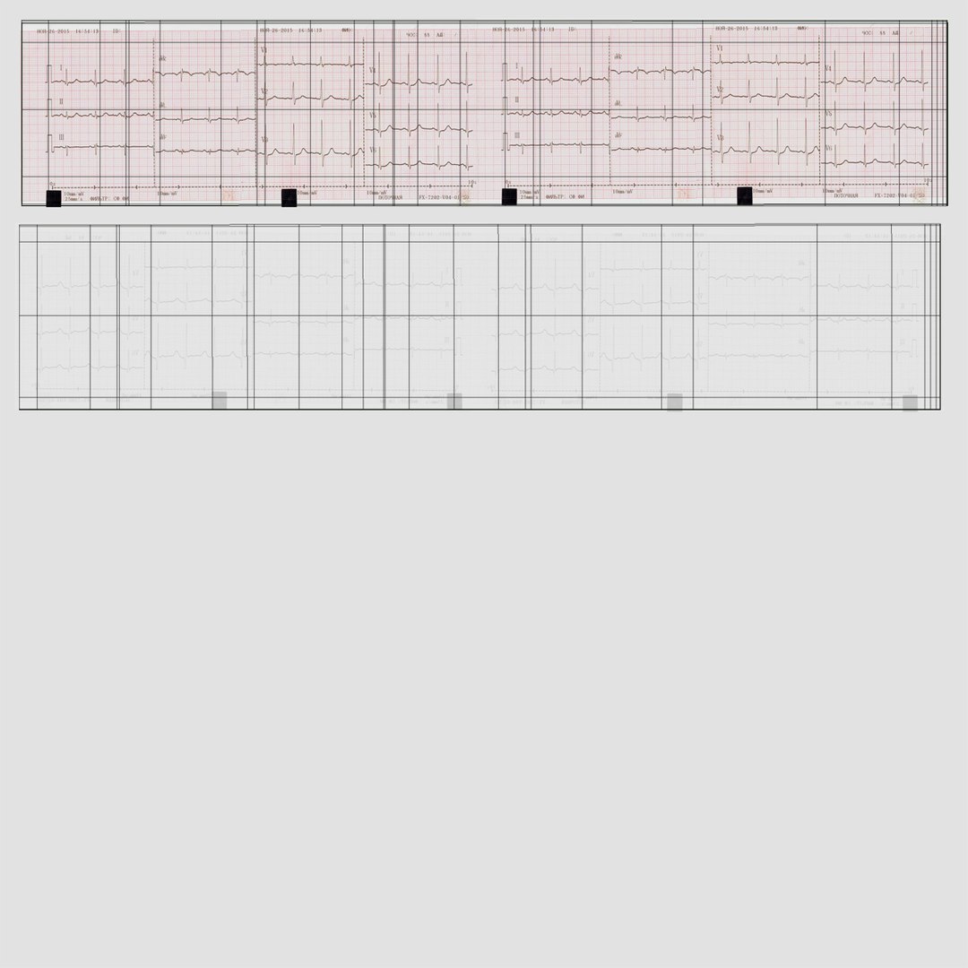 Electrocardiograph Report Paper Form Max