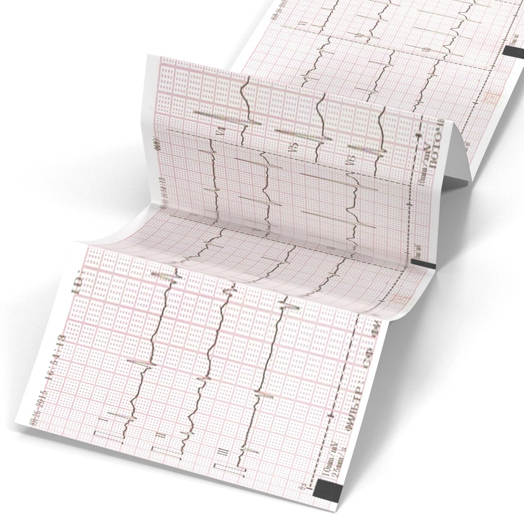 Electrocardiograph Report Paper Form Max