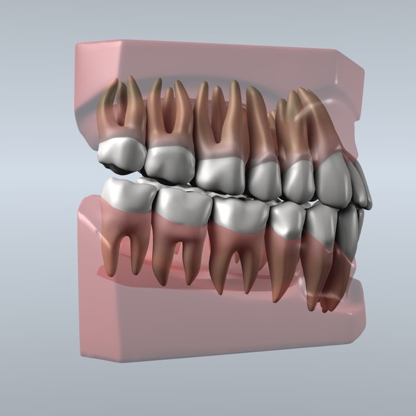 3d model dentist teeth gums modeled