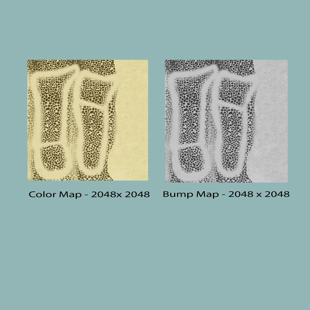 rheumatoid arthritis 3d model