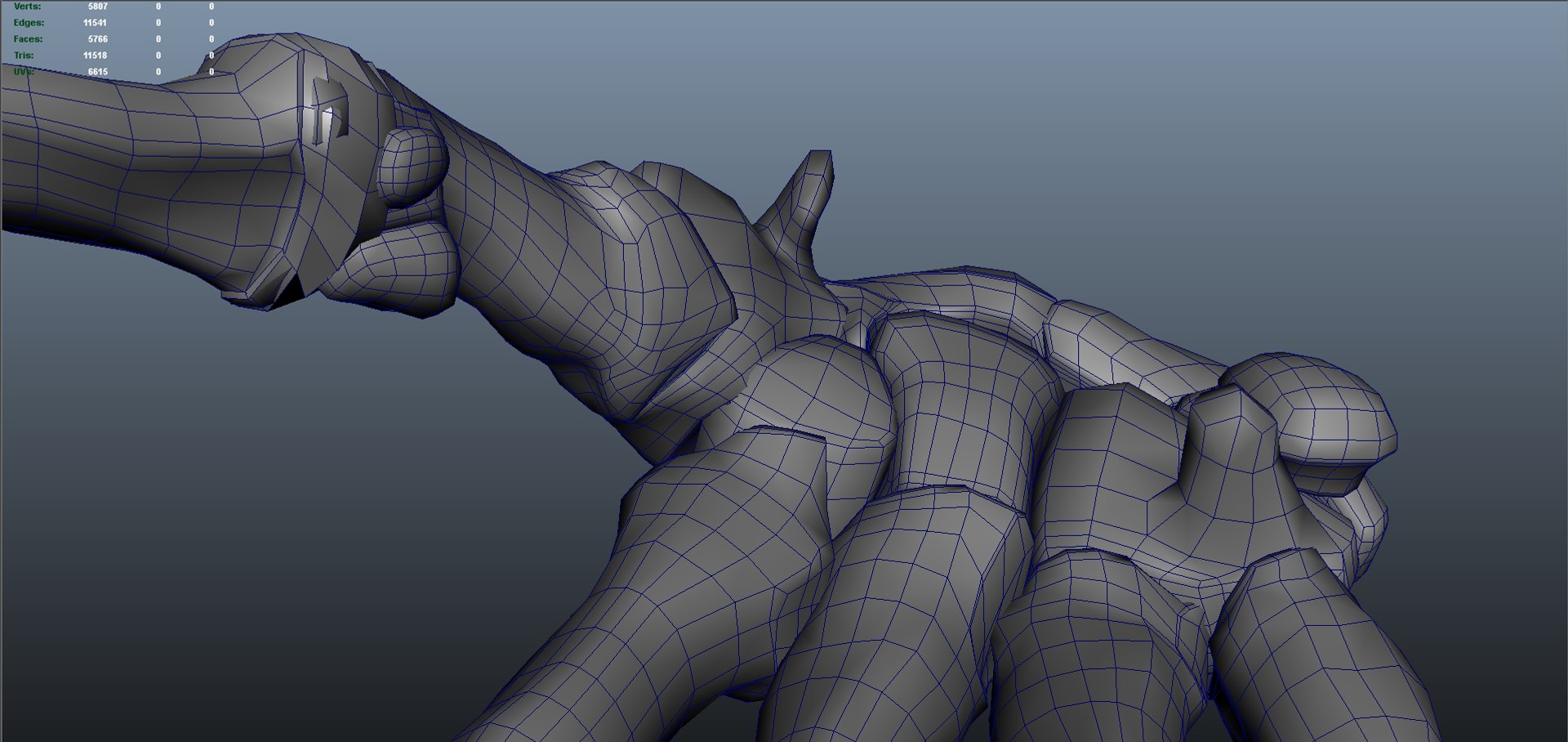 rheumatoid arthritis 3d model